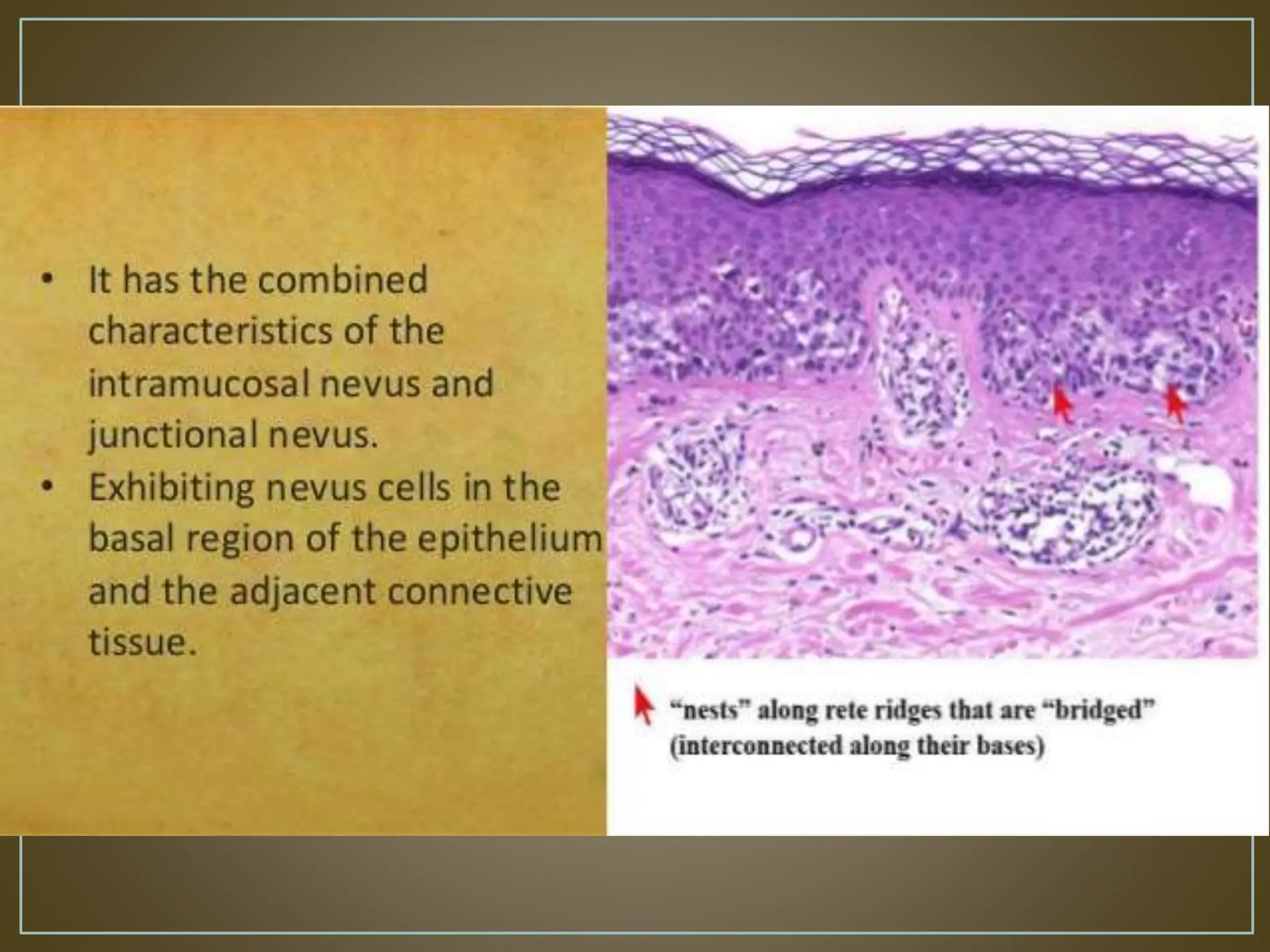 Pathology of the skin skin pathology skin | PPTX