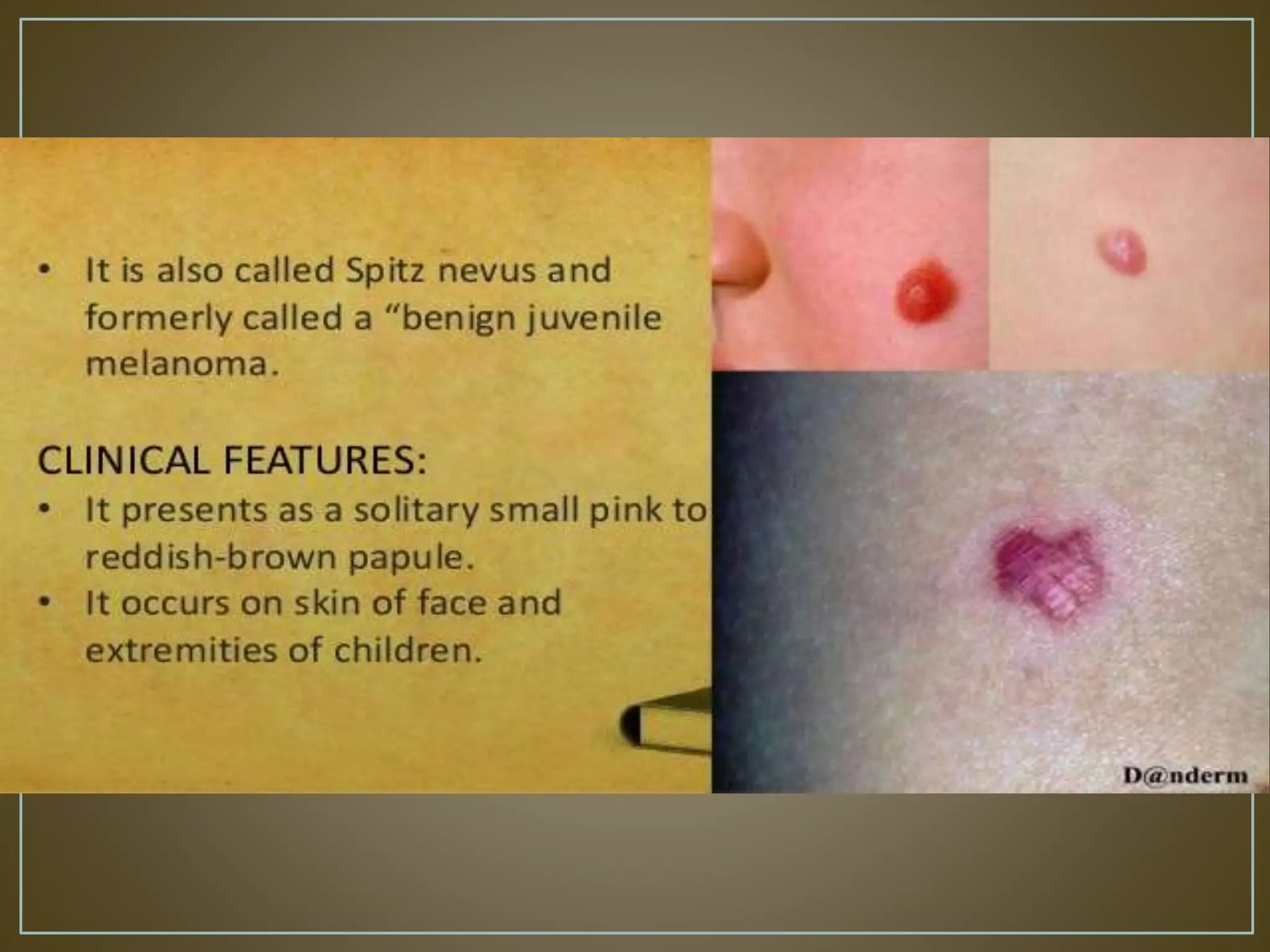 Pathology of the skin skin pathology skin | PPTX