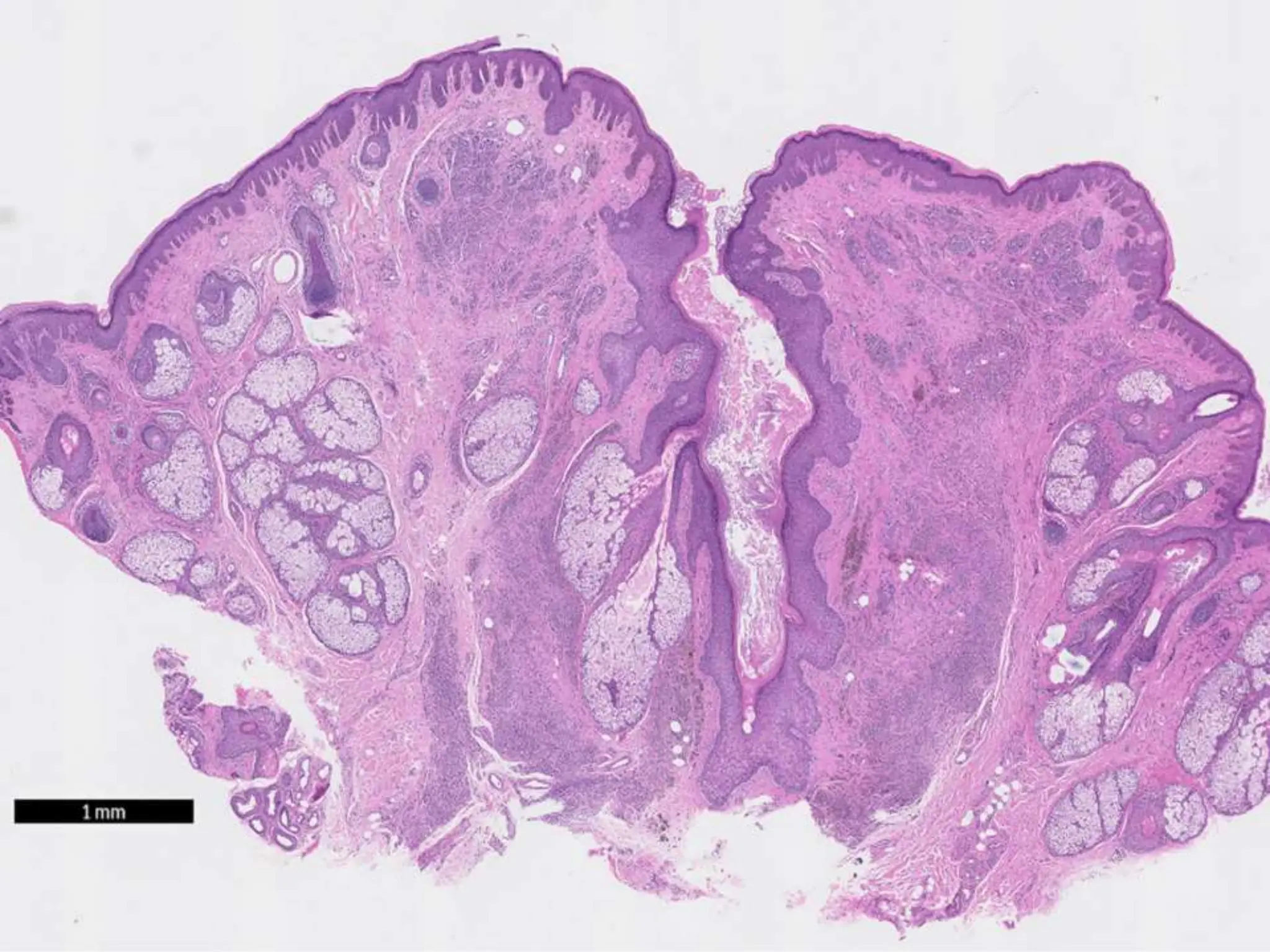 Pathology of the skin skin pathology skin | PPTX