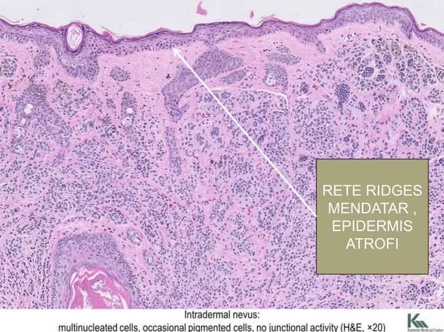 Pathology of the skin skin pathology skin | PPTX | Skin and Dermatology ...