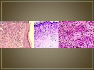 Pathology of the skin skin pathology skin | PPTX