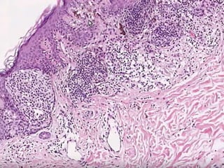 Pathology of the skin skin pathology skin | PPTX