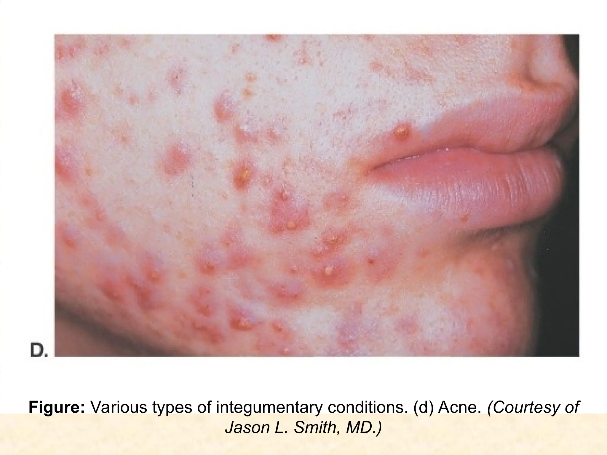 Skin Pathology (Disease of the Integumentary System) | PPT