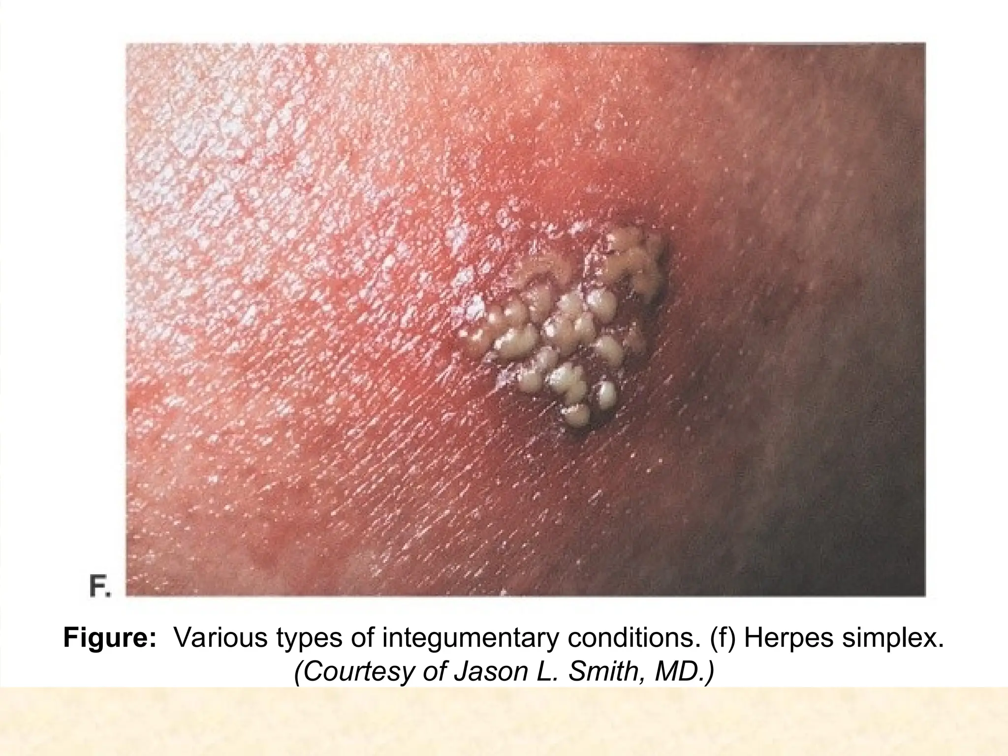 Skin Pathology (Disease of the Integumentary System) | PPT