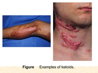 Skin Pathology (Disease of the Integumentary System) | PPT