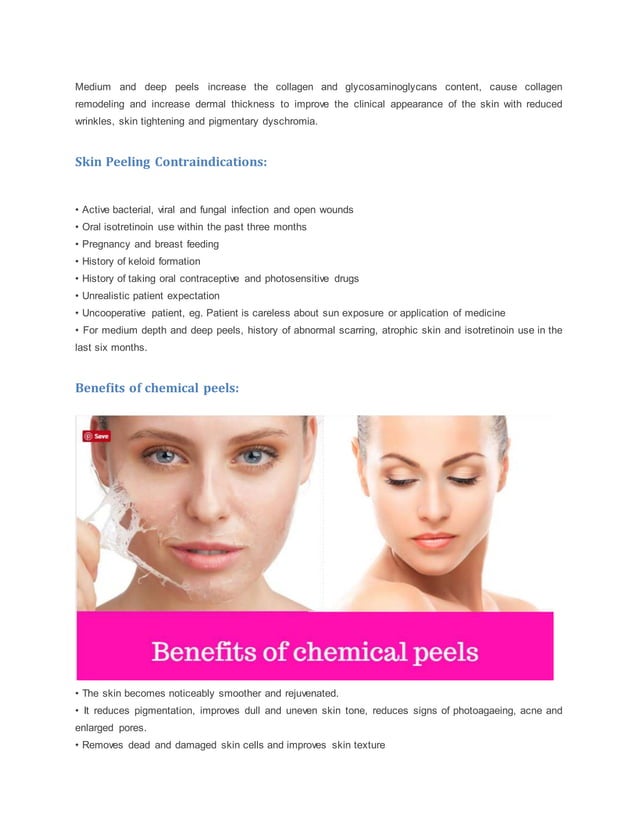 Complete Guide Of Skin Peeling Treatment For Skin | PDF