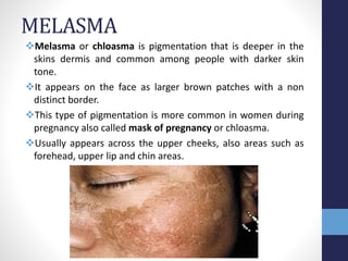 Skin pigmentation | PPTX