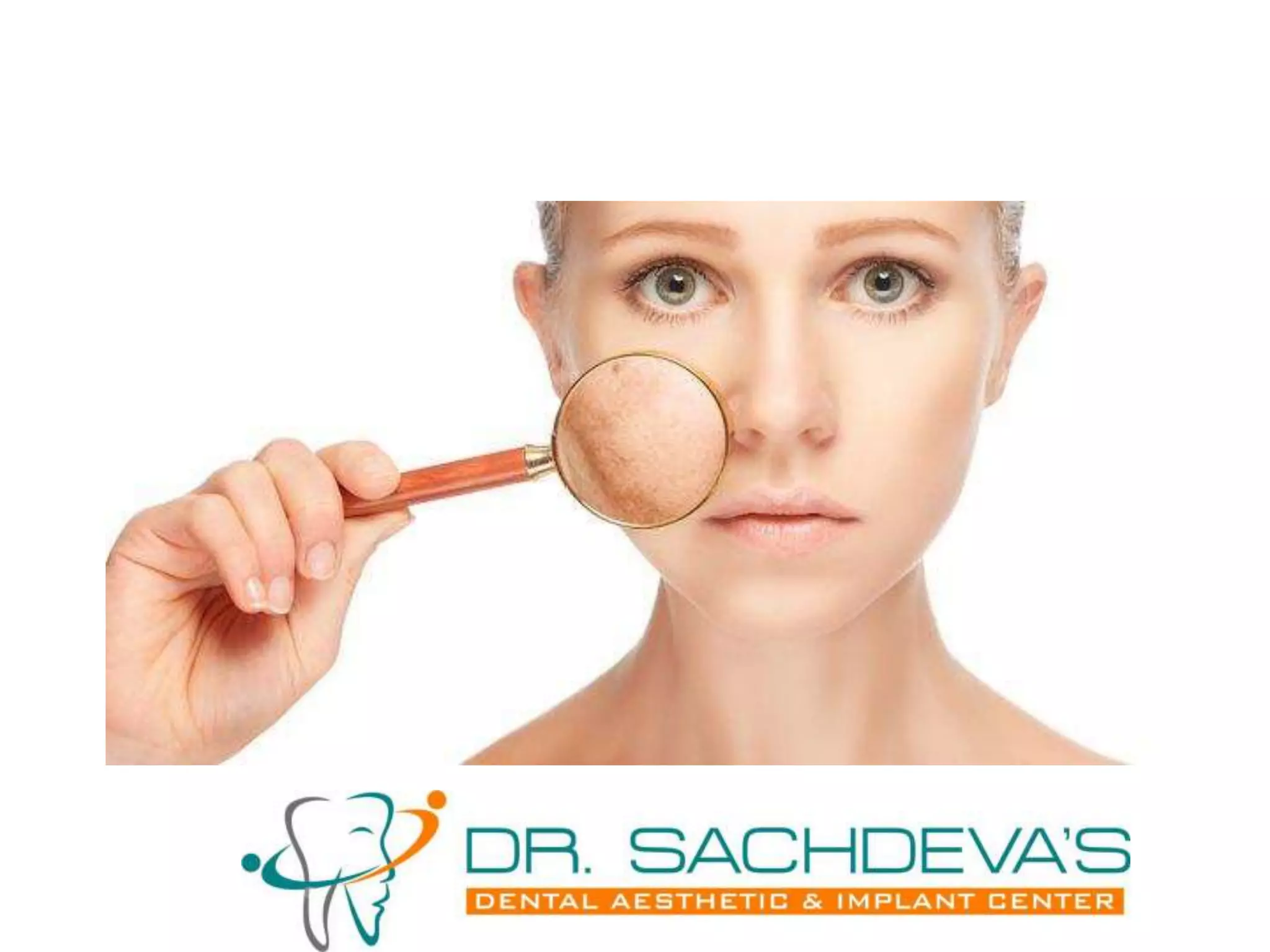 Skin pigmentation | Skin Pigmentation Disorders | PPTX