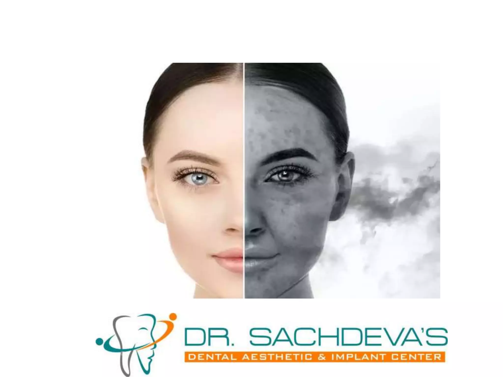 Skin pigmentation | Skin Pigmentation Disorders | PPTX