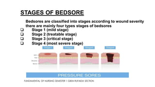 Skin Ulcers Presentation | PDF