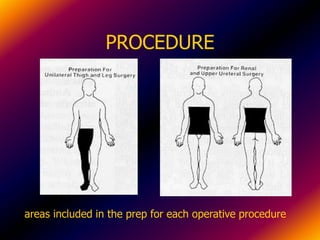 Skin Preparation 546546549877987897897897.ppt