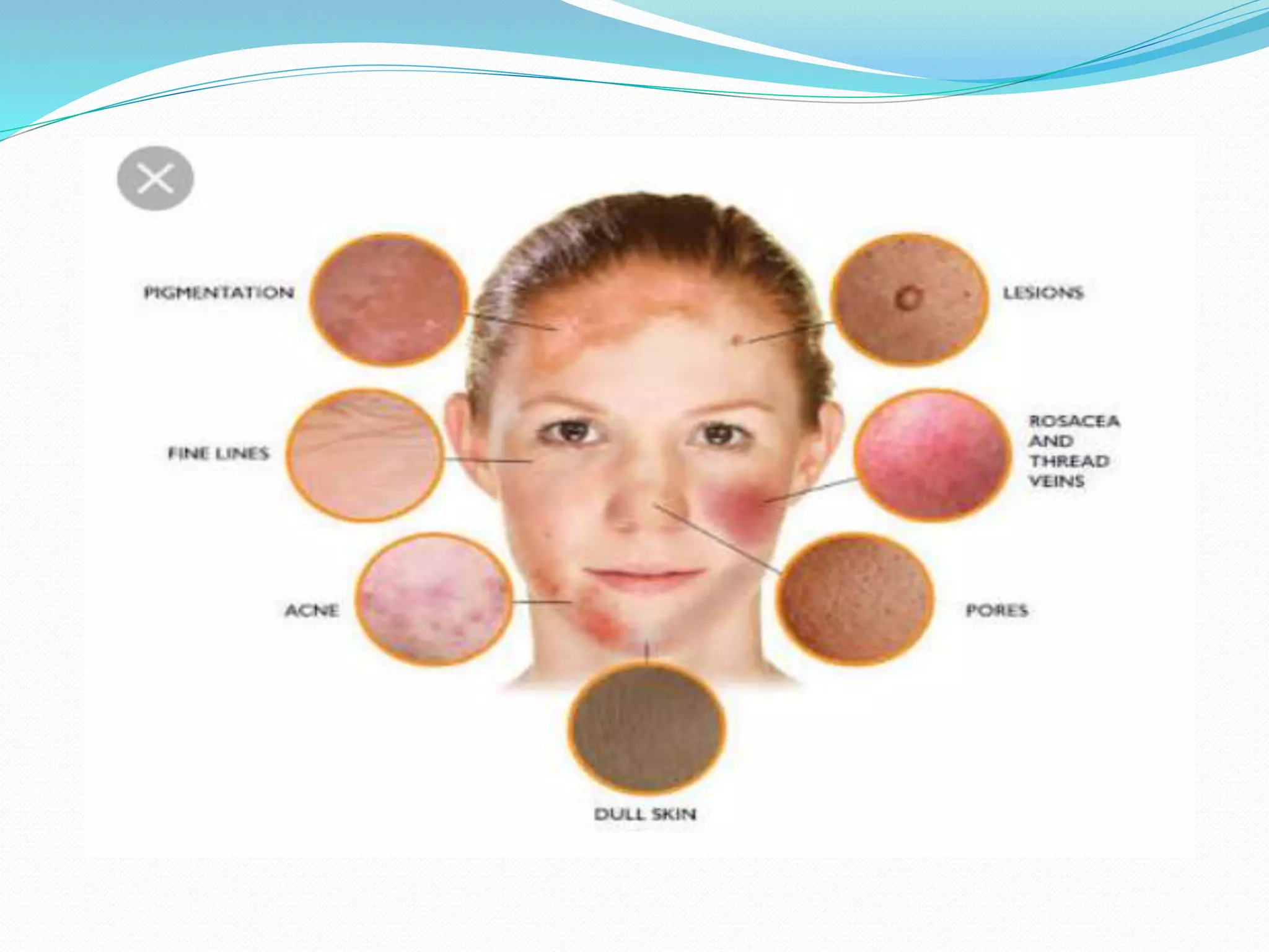 Skin presentation | PPTX