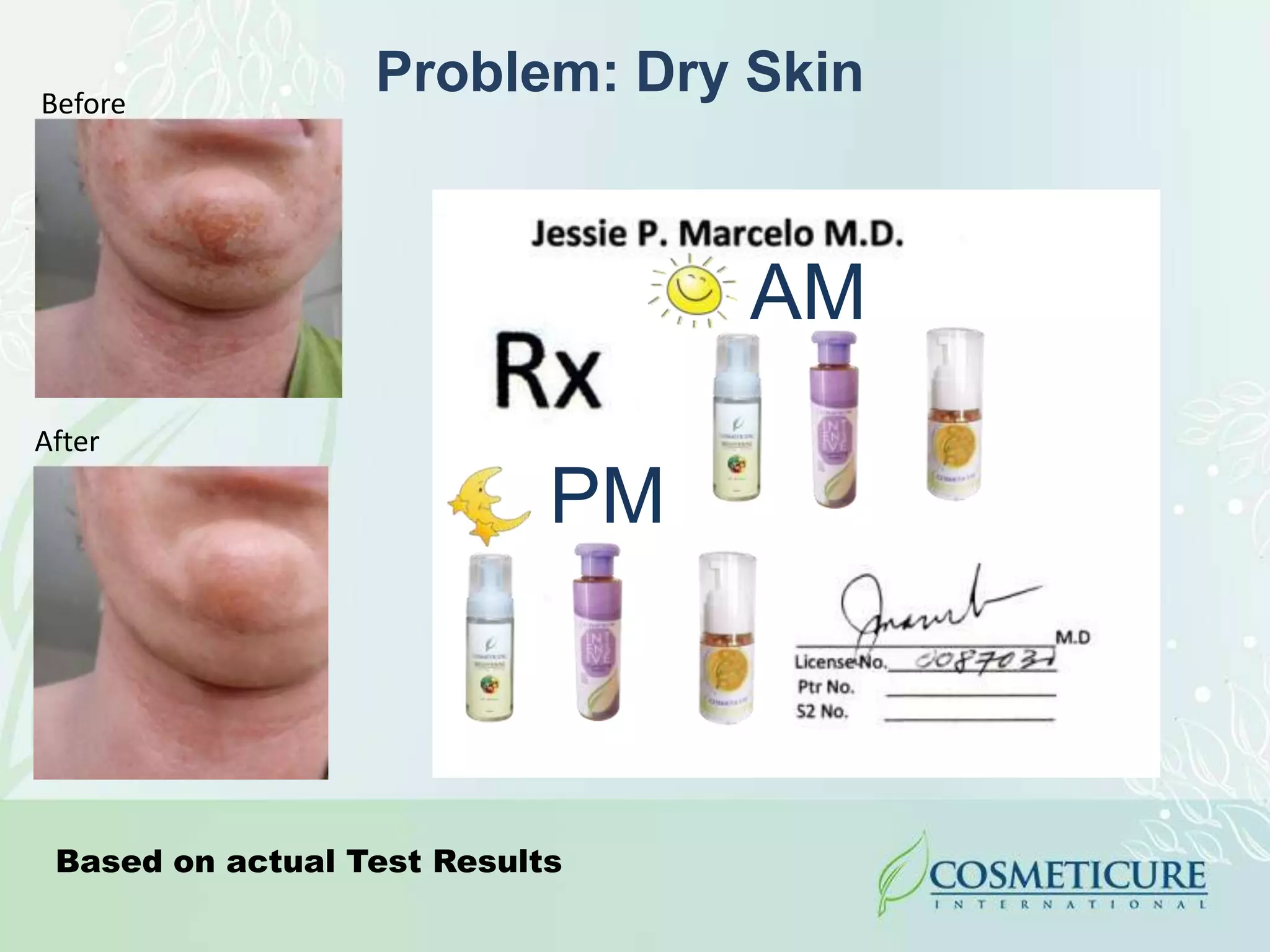 Cosmeticure: Skin Problem Solutions | PPT