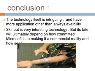 Skinput Technology | PPT