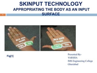 Skinput technology appropriating the body as an input surface | PPTX ...