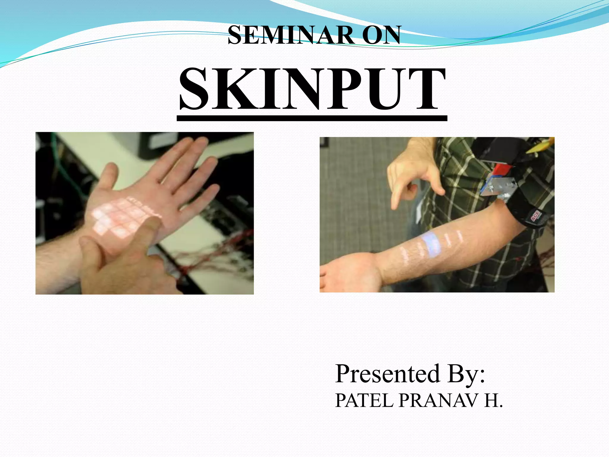 Skinput Technology | PPTX | Computer Peripherals | Computing