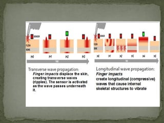 skinput-150825121232-lva1-app6891.pdf