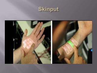 Skinput | PPT