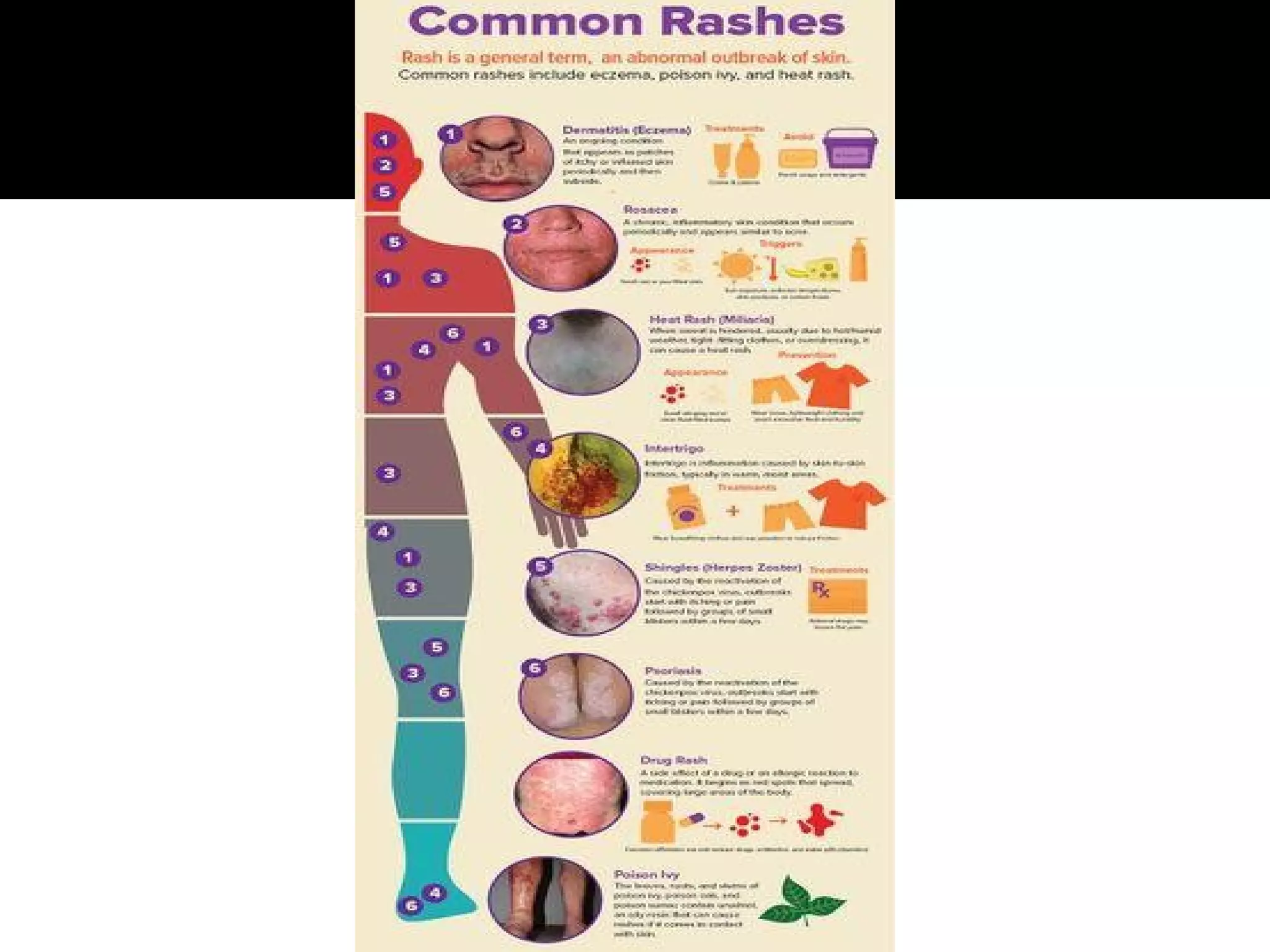 Skin rash | PPT