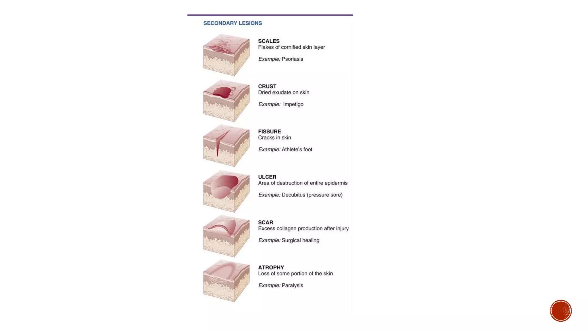Approach to Skin rash | PPTX