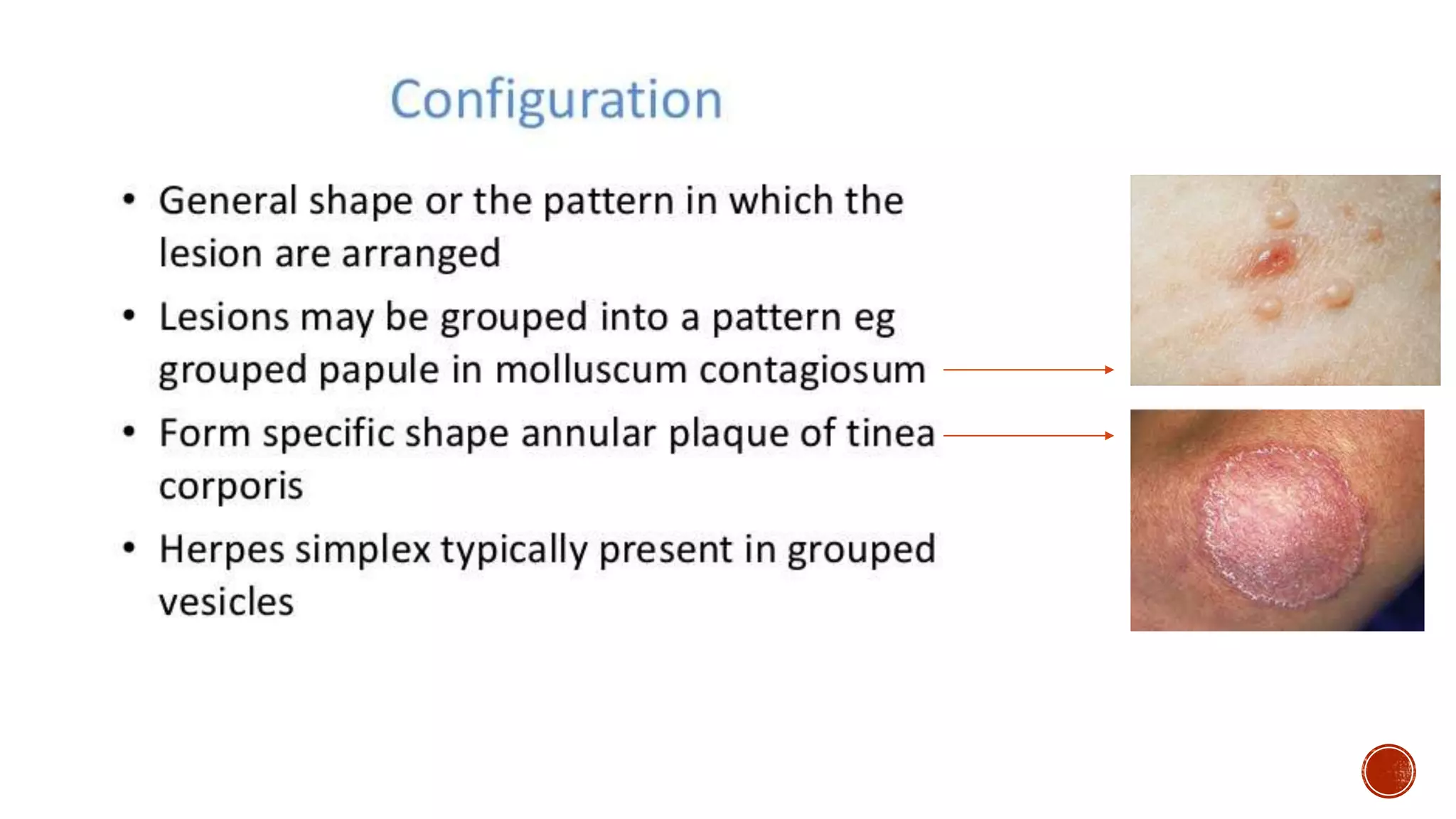 Approach to Skin rash | PPTX