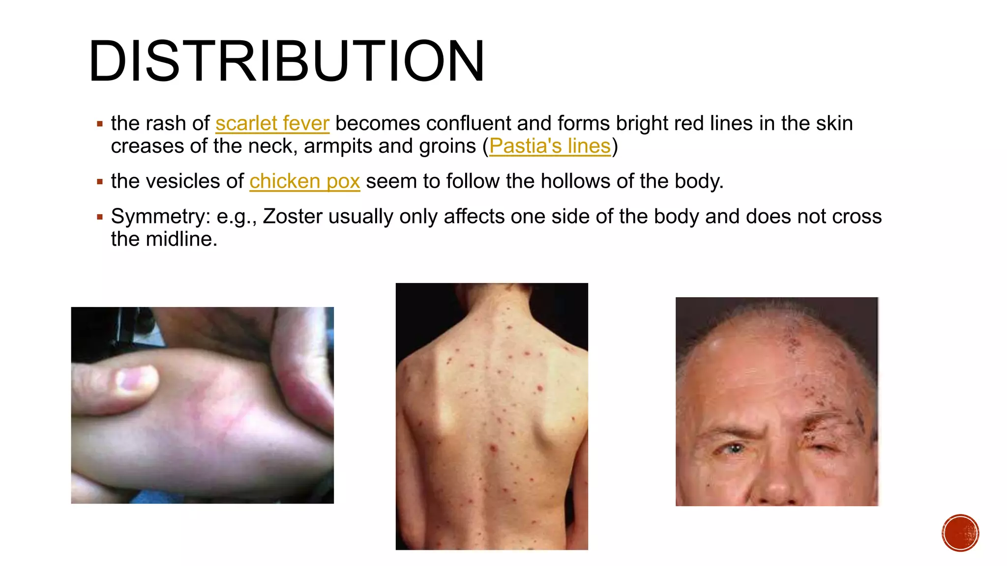 Approach to Skin rash | PPTX