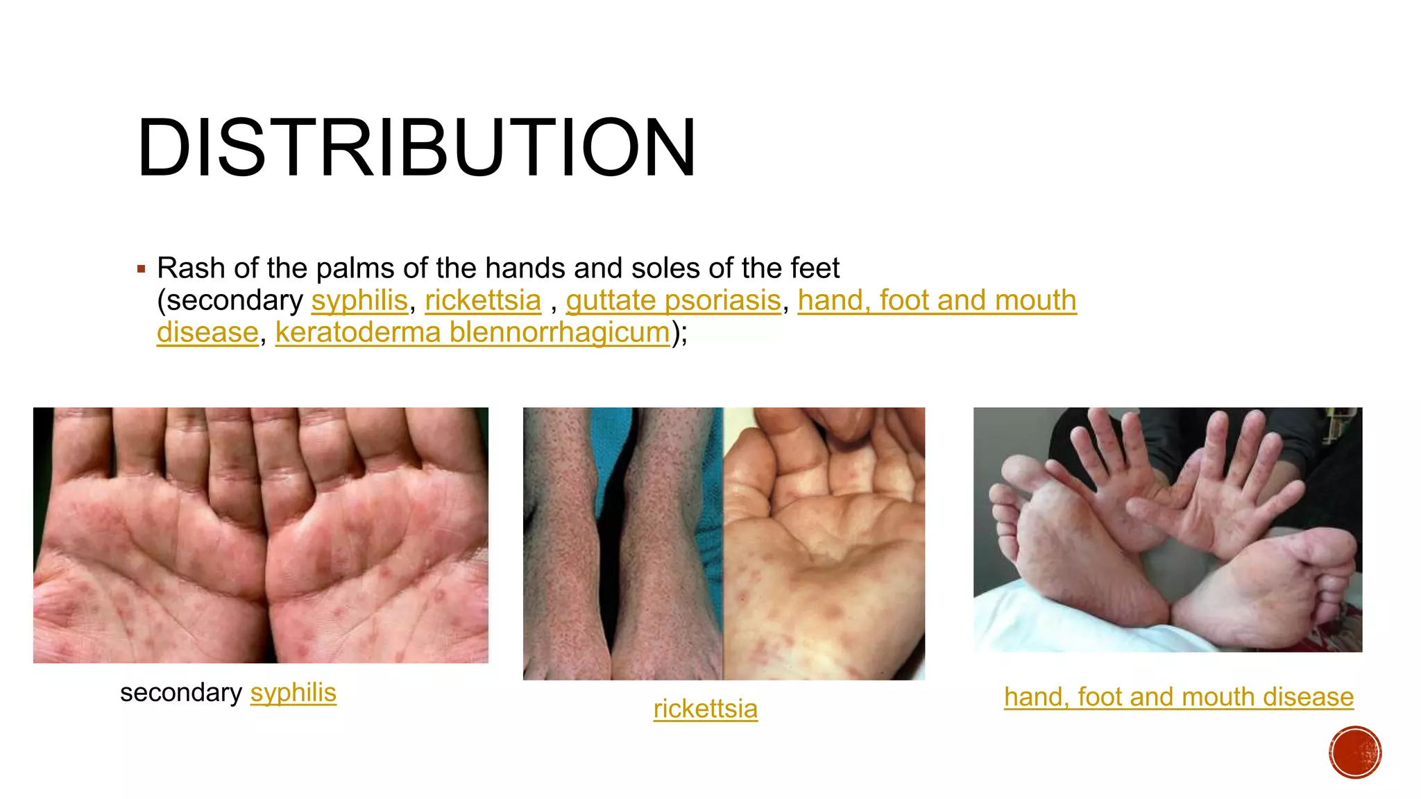 Approach to Skin rash | PPTX