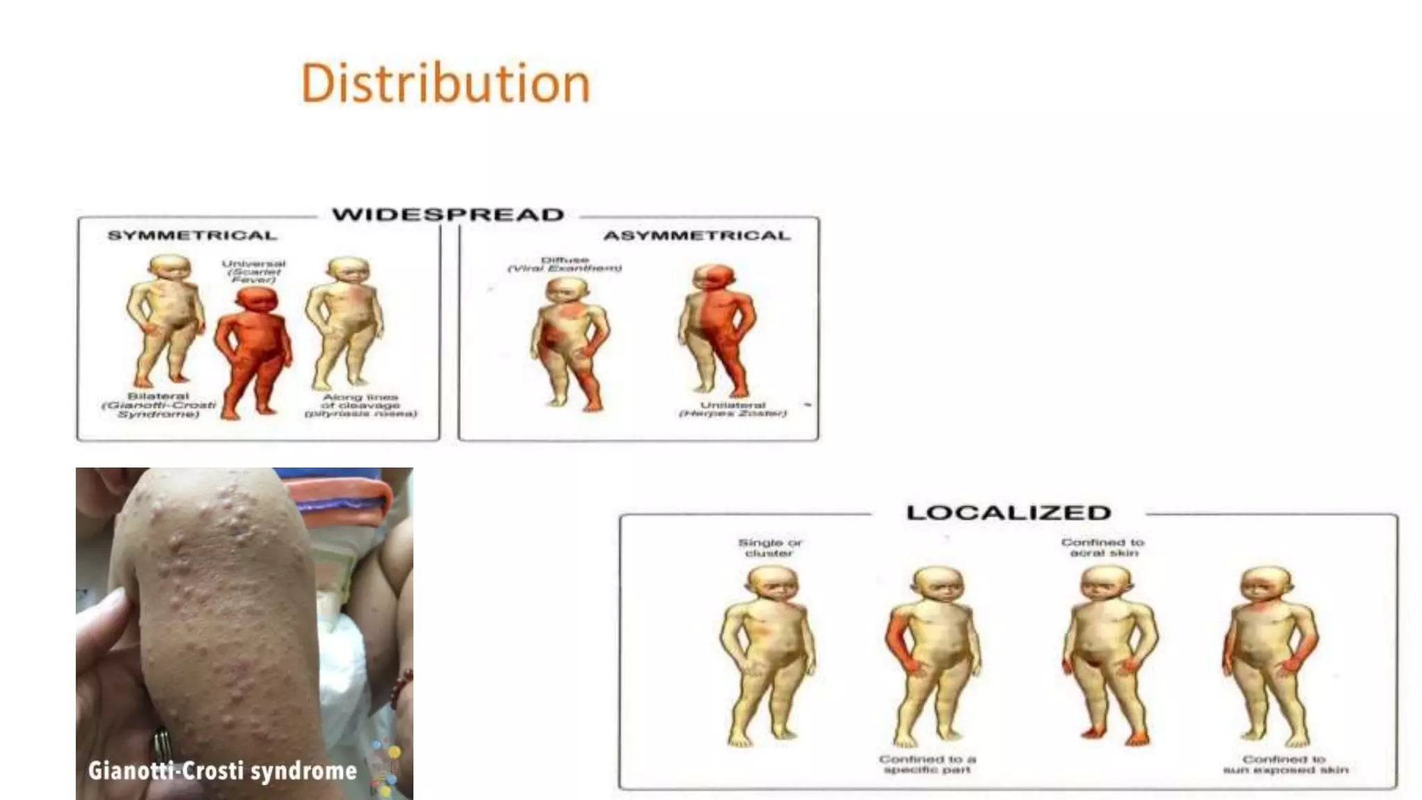 Approach to Skin rash | PPTX
