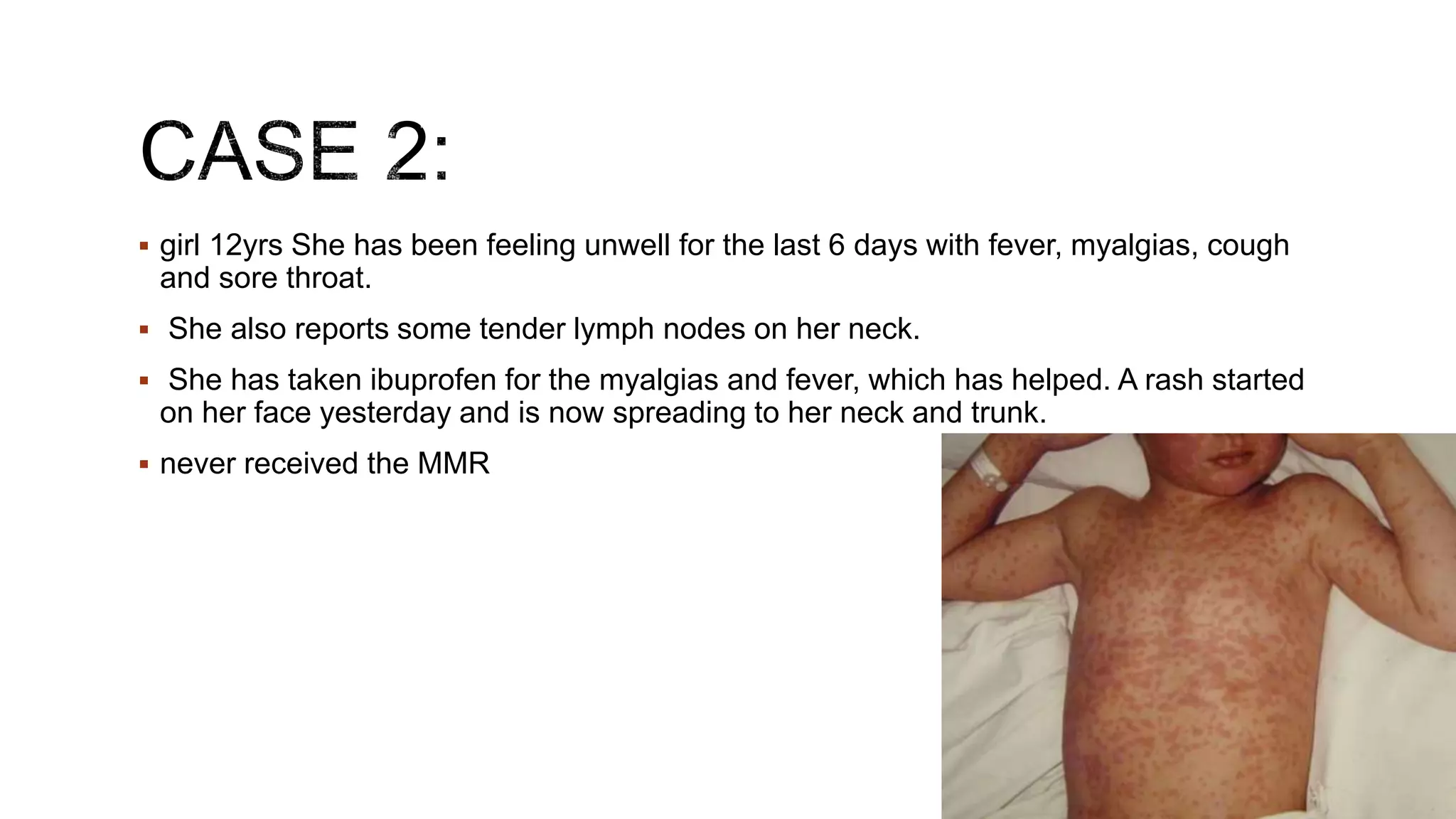 Approach to Skin rash | PPTX