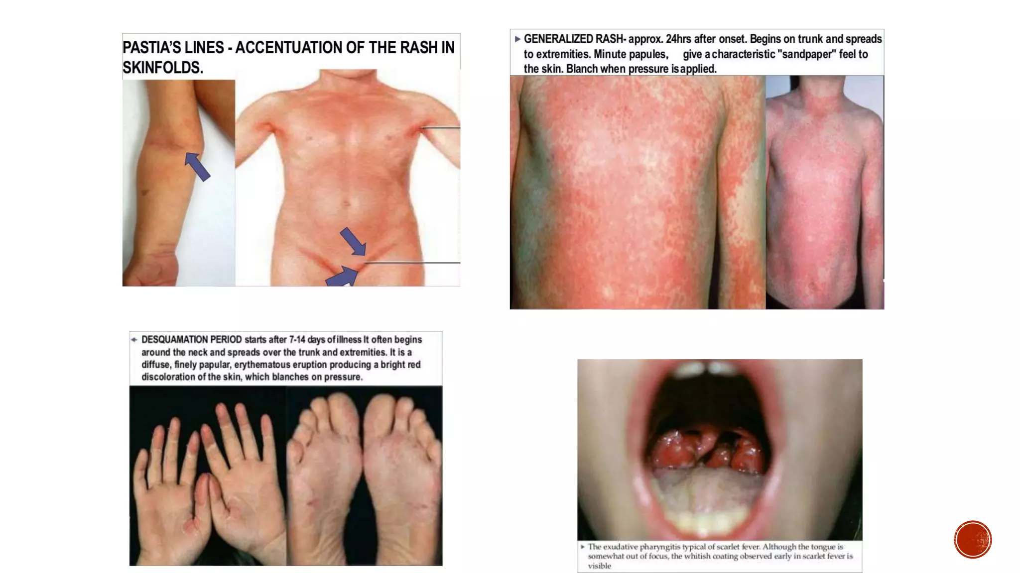 Approach to Skin rash | PPTX