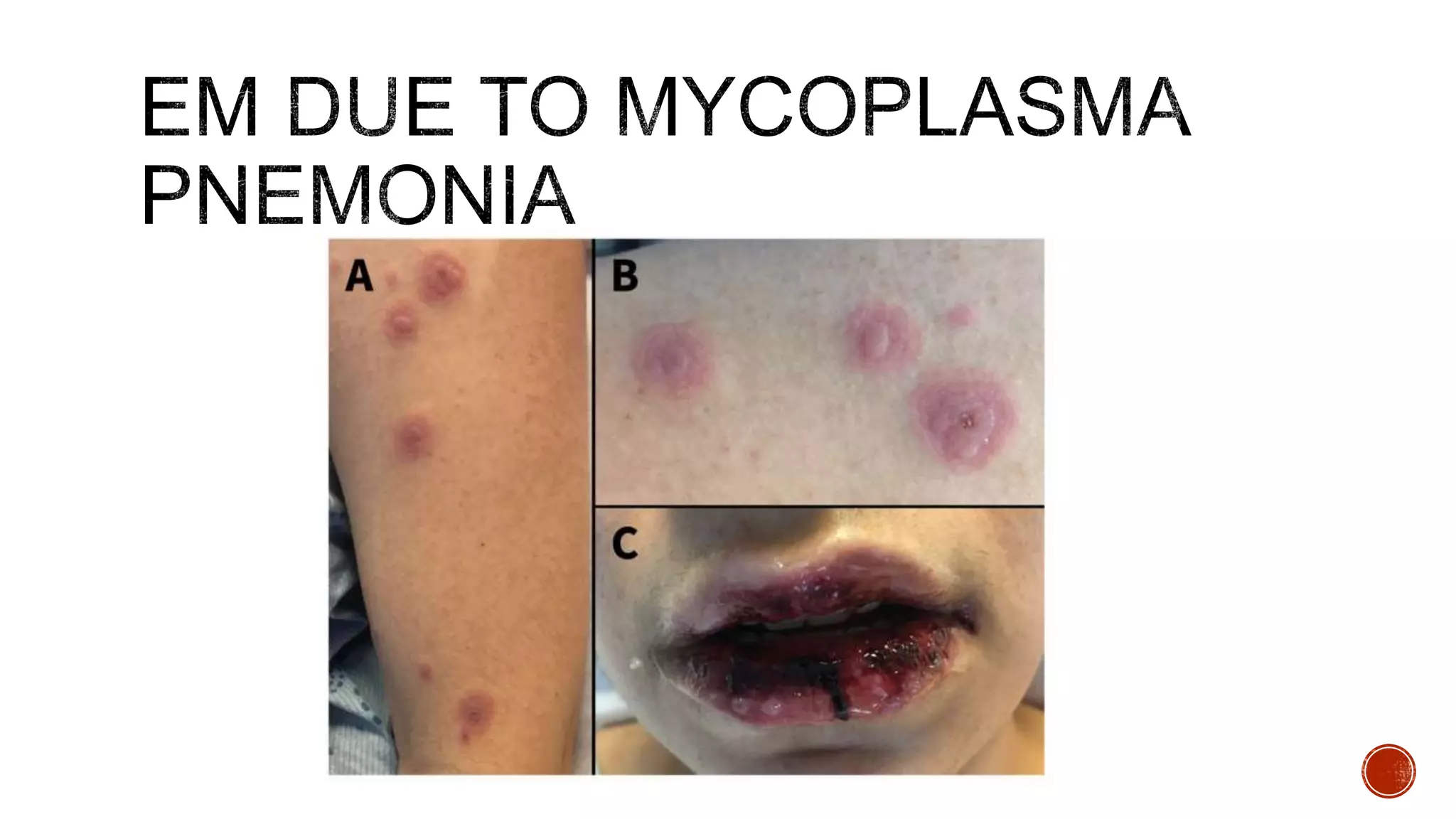 Approach to Skin rash | PPTX