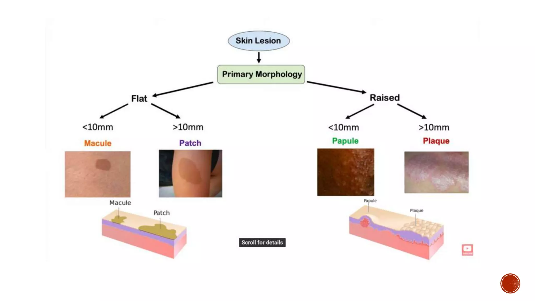 Approach to Skin rash | PPTX