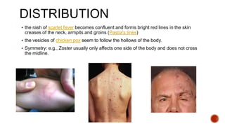 Approach to Skin rash | PPTX