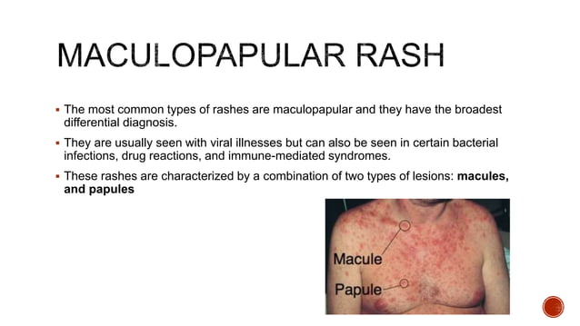 Approach to Skin rash | PPTX