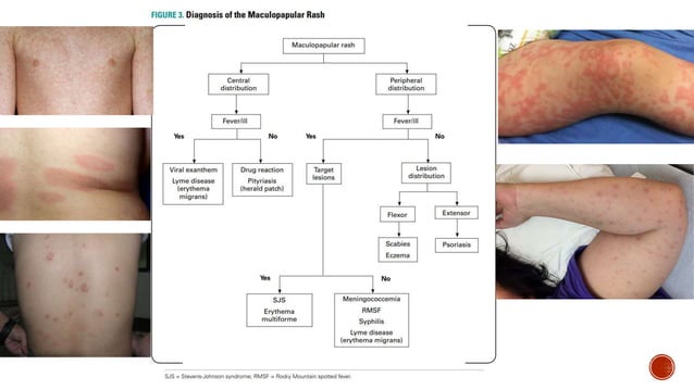 Approach to Skin rash | PPTX