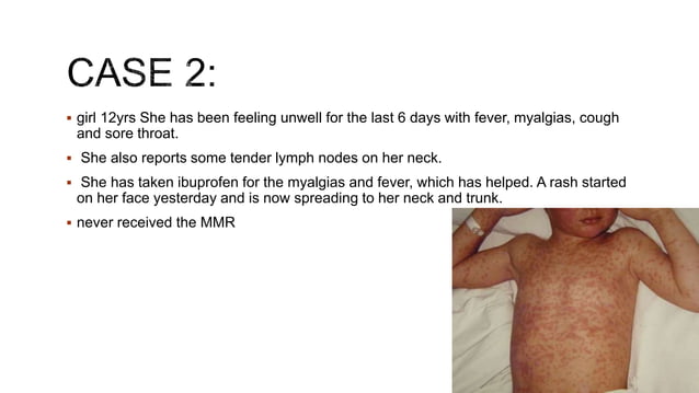 Approach to Skin rash | PPTX