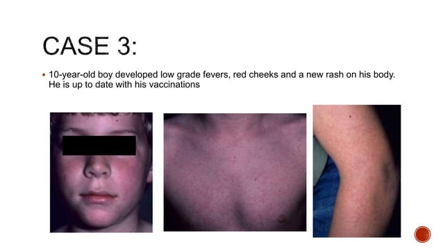 Approach to Skin rash | PPTX