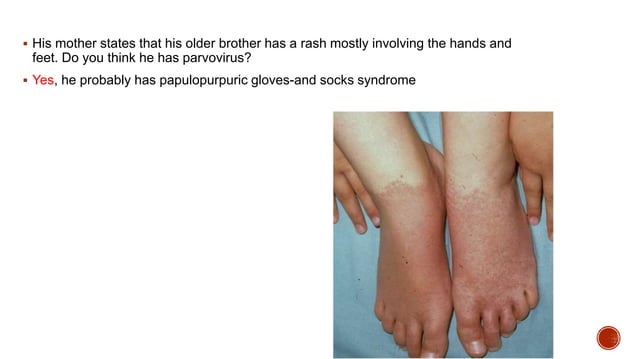 Approach to Skin rash | PPTX