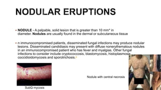 Approach to Skin rash | PPT