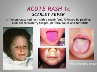 skin rash for dermatology field in medical field | PPT