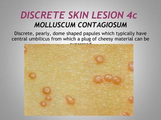 skin rash for dermatology field in medical field | PDF