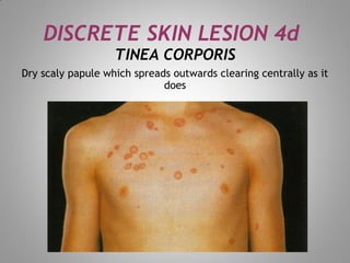 skin rash for dermatology field in medical field | PDF