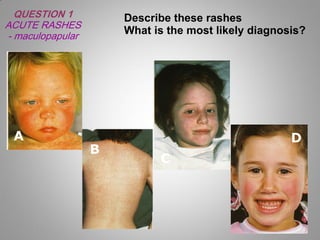 skin rash for dermatology field in medical field | PDF