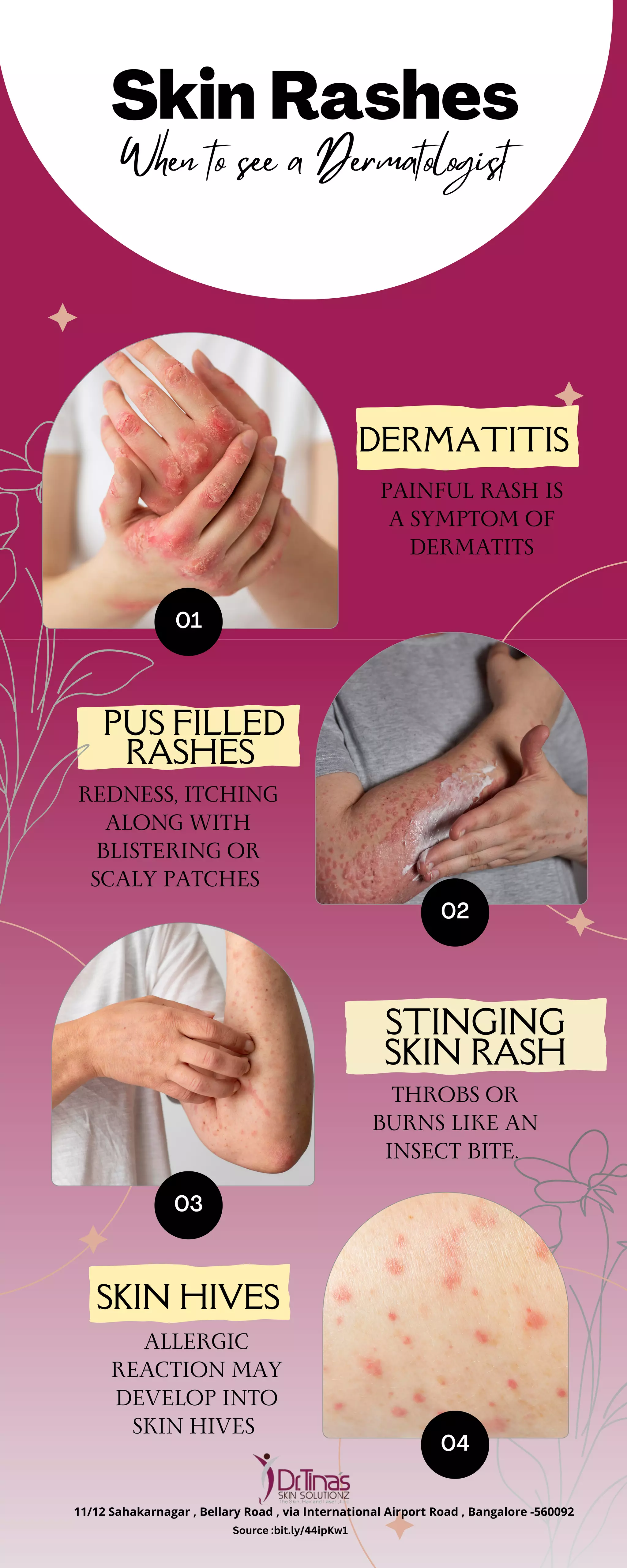 Types of Summer Skin Rashes | PDF