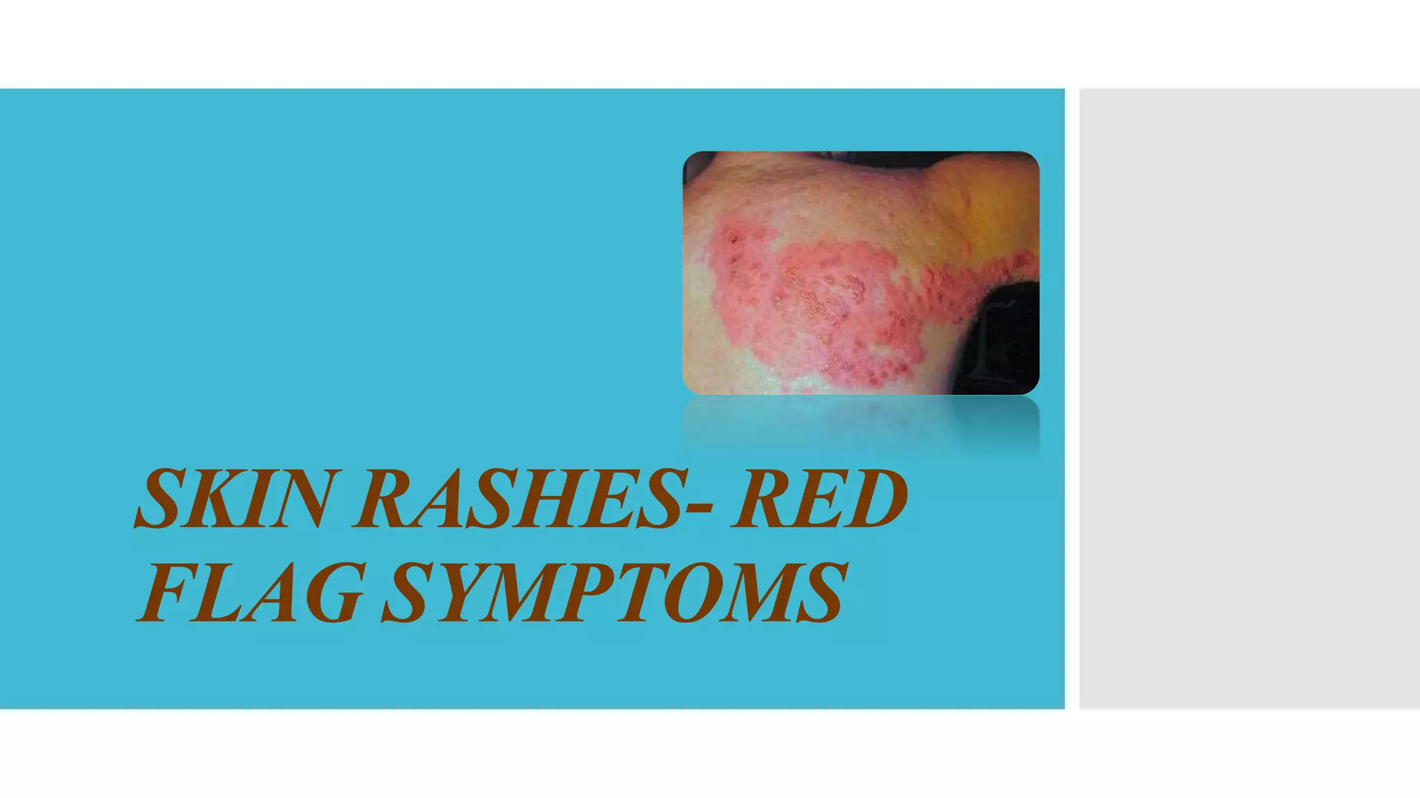 Skin rashes red flag symptoms | PPTX