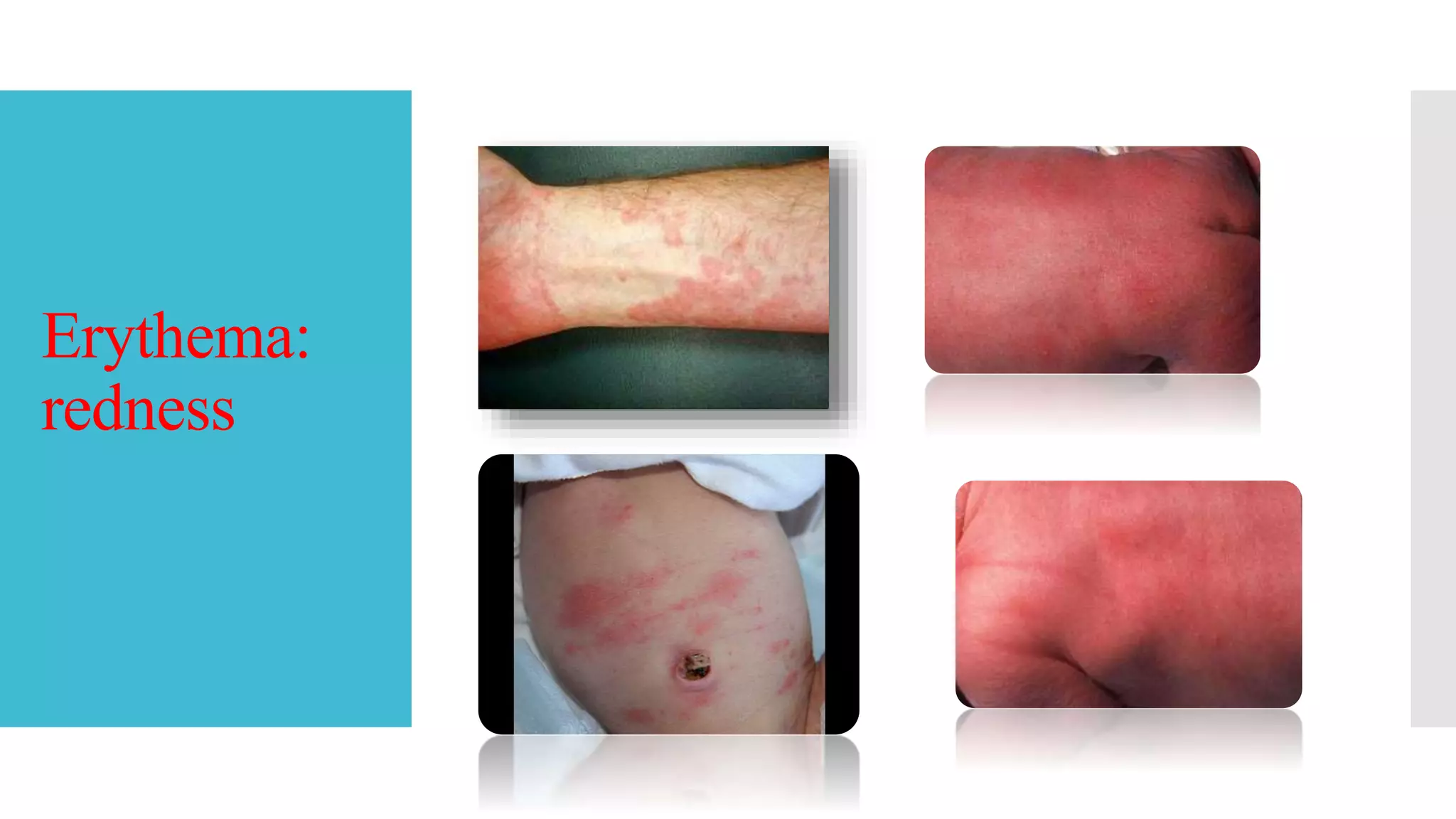 Skin rashes red flag symptoms | PPTX