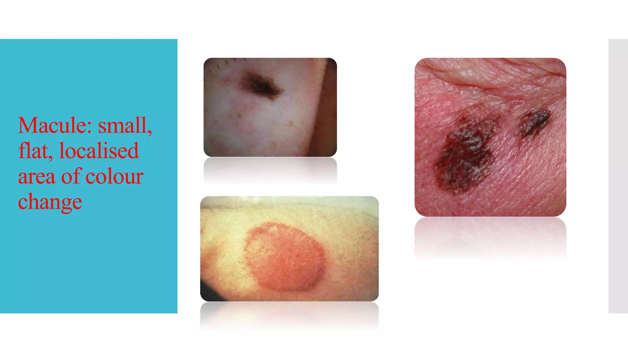 Skin rashes red flag symptoms | PPTX