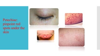 Skin rashes red flag symptoms | PPTX