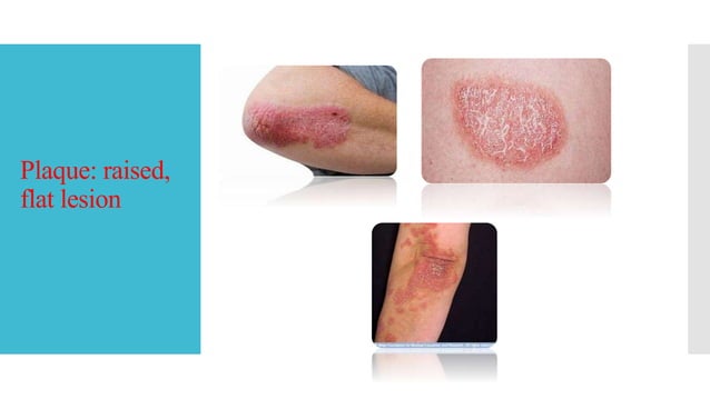 Skin rashes red flag symptoms | PPTX