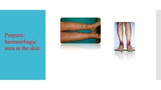 Skin rashes red flag symptoms | PPTX